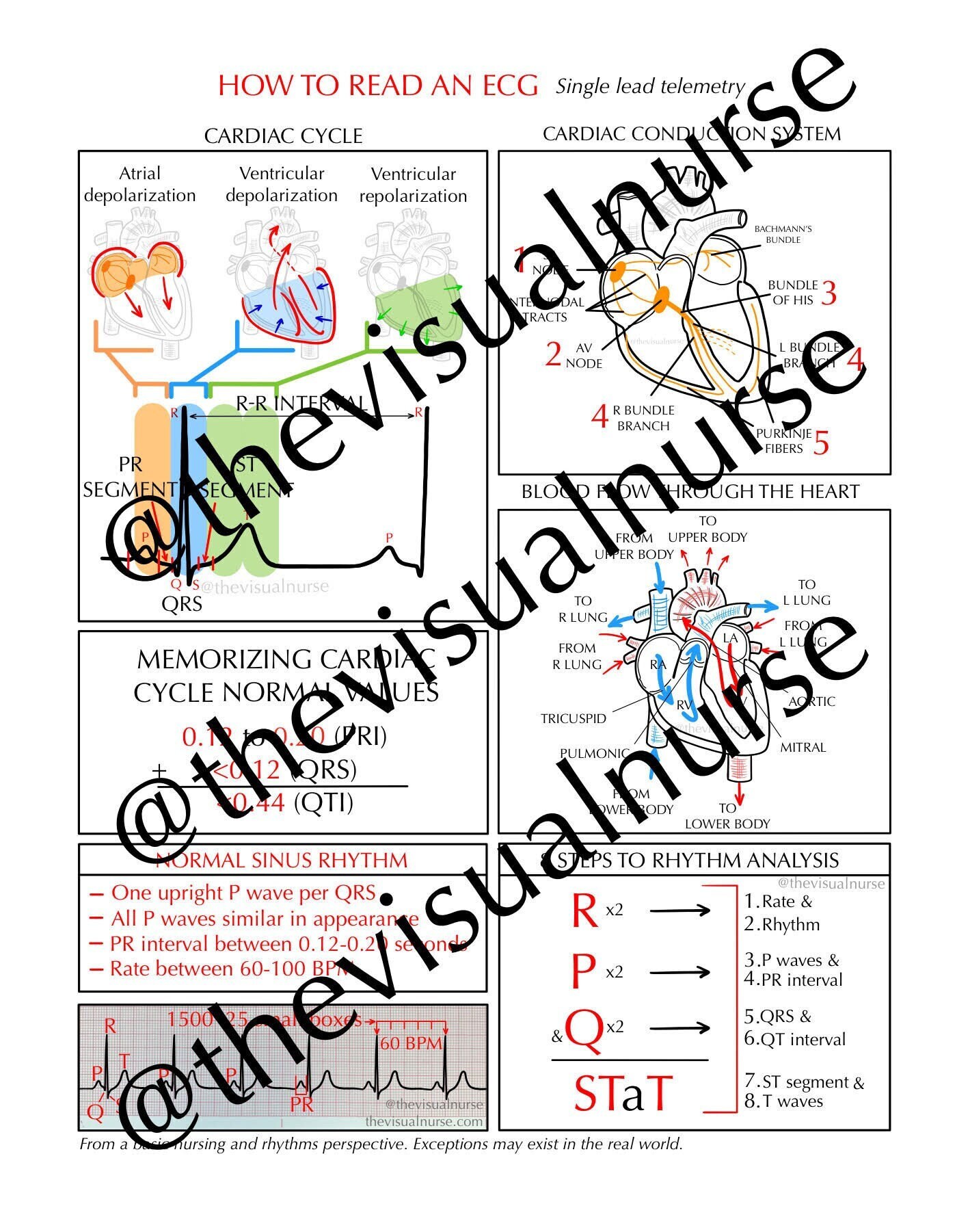 How to Read an ECG Single Lead Telemetry PDF Instant Download - Etsy