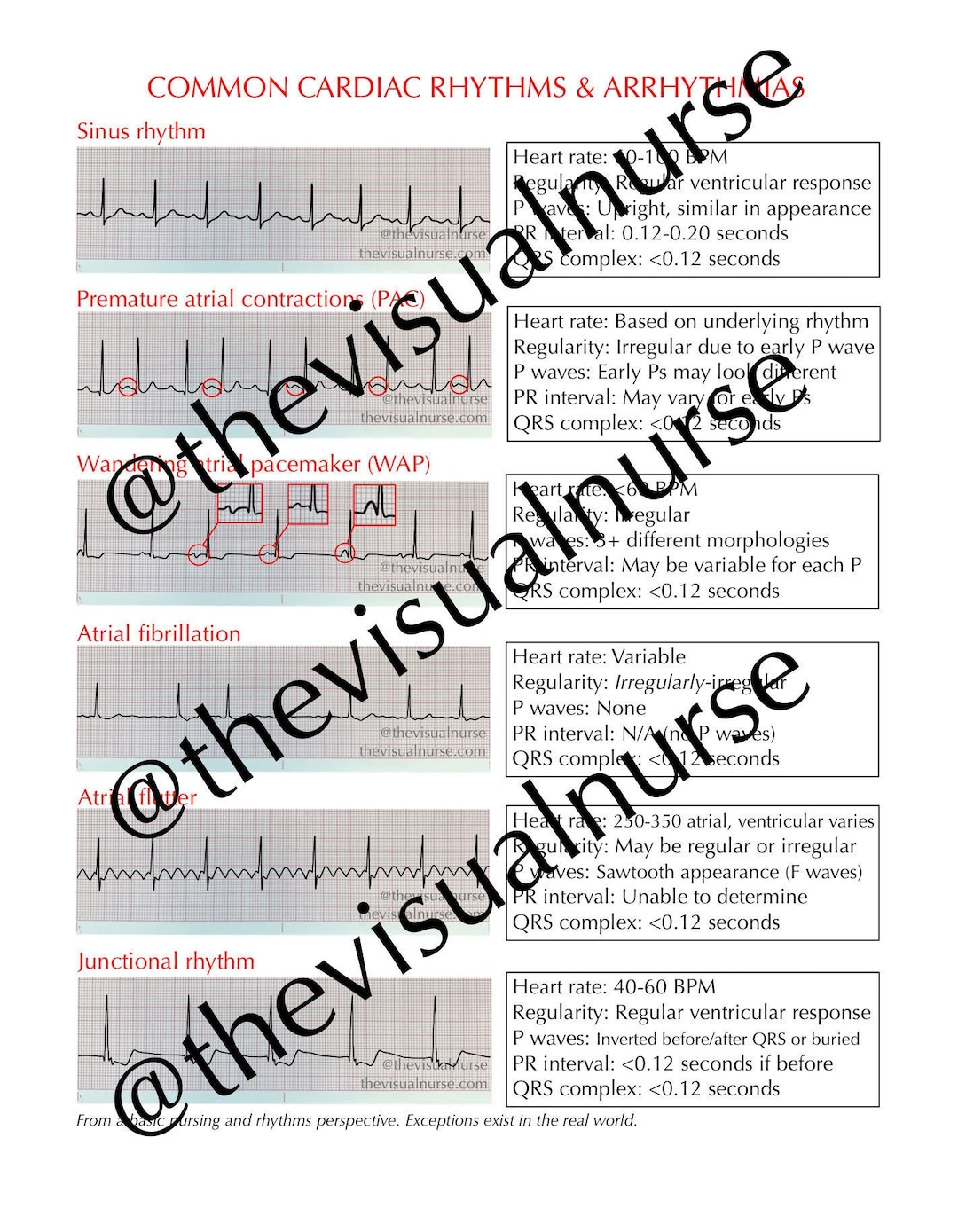 Common Cardiac Rhythms and Arrhythmias - PDF Instant Download - Etsy