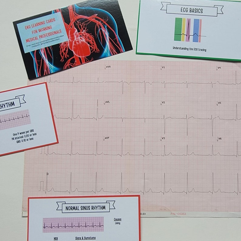 Master EKG Foundation Flashcards | Study on the Go | Cardiac Tele ...