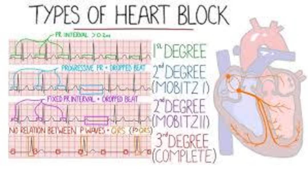 PCCN STUDY GUIDE 2025 - Etsy