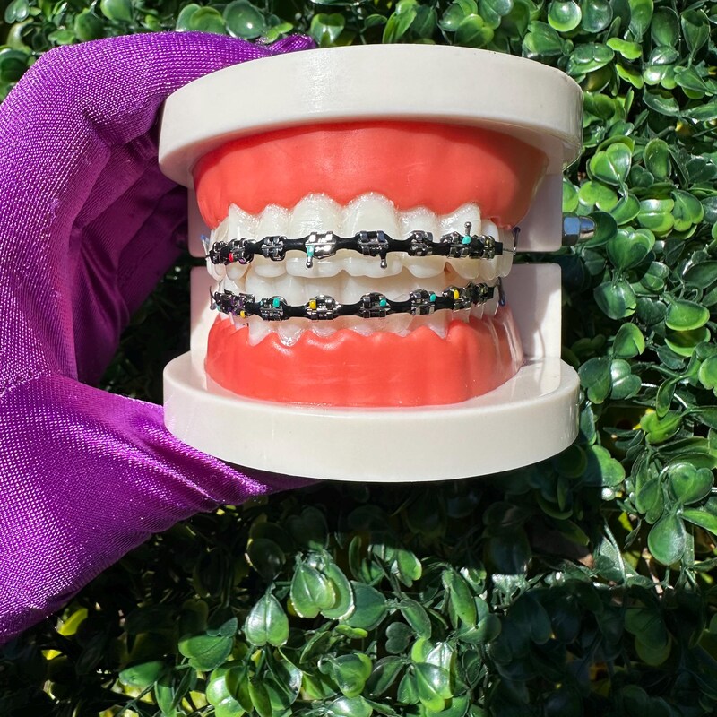 Fake Braces Clip On - Etsy