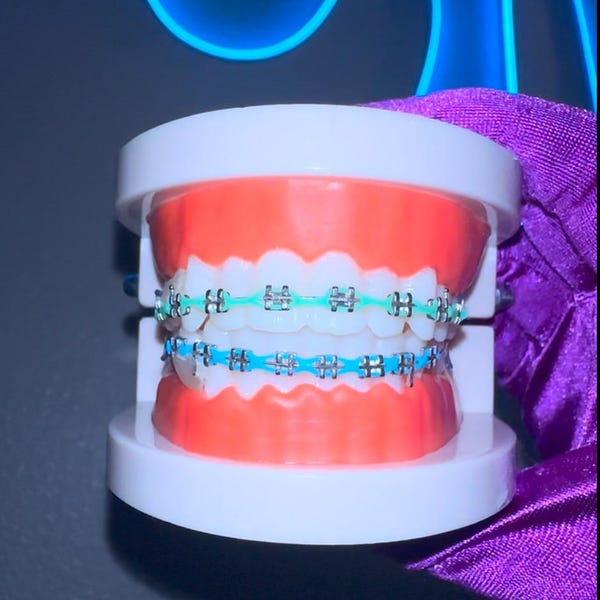 Fake Braces Clip On - Etsy