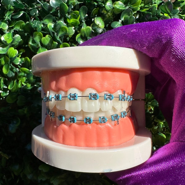 Fake Braces Clip On - Etsy