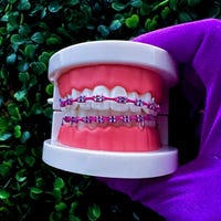 Fake Braces - Etsy
