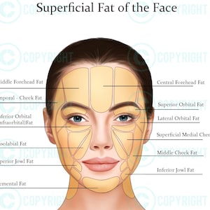 Male BOTOX Injection Points Bundle Botox & Filler Injector Anatomy ...