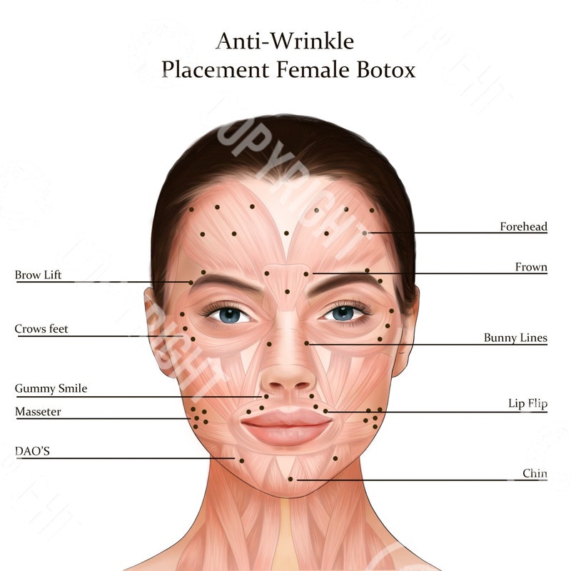 Botox Face Chart - Etsy
