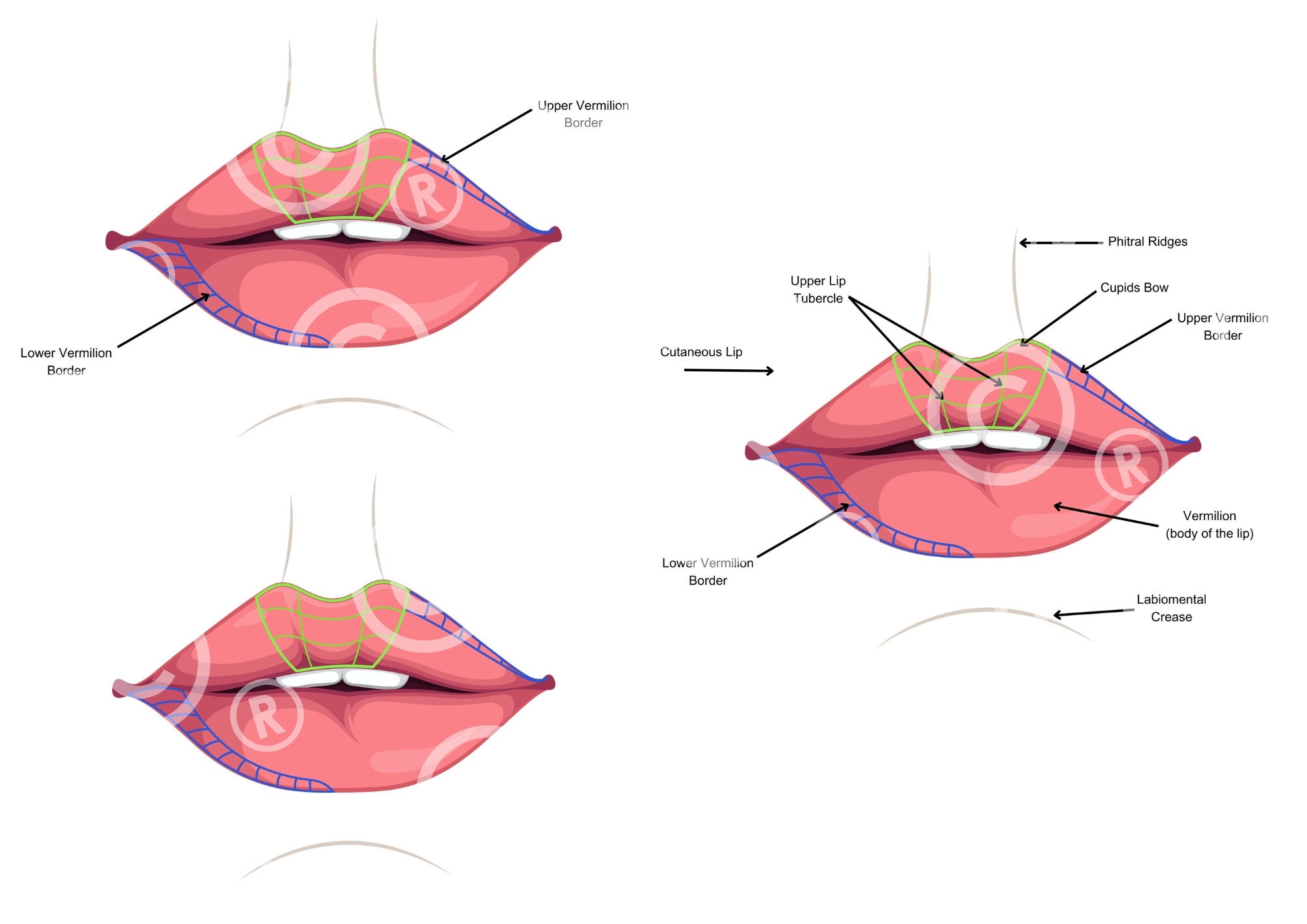 Fundamental Lip Filler Injection Techniques Dermal Filler Anatomy Injector Esthetician ...