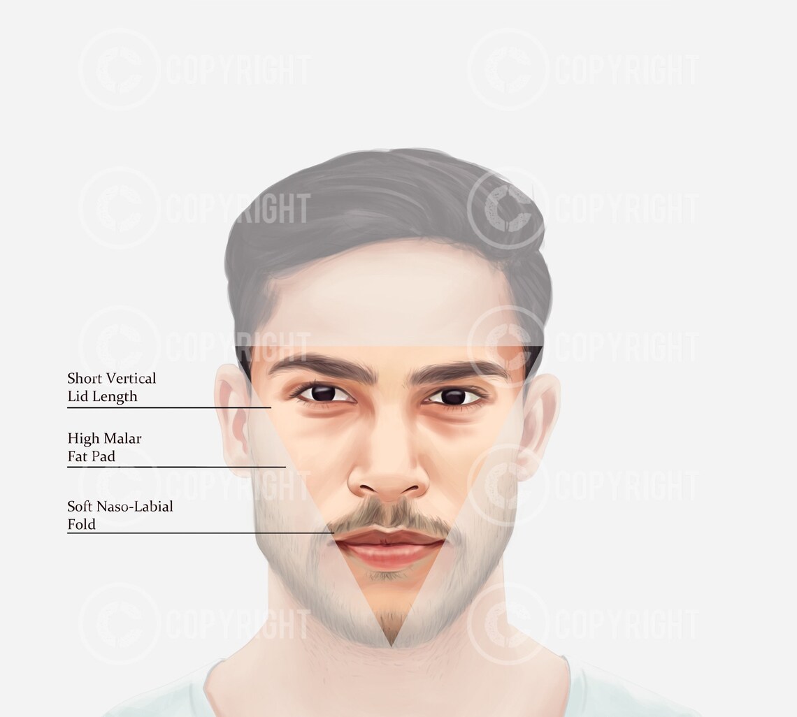 Bundle | Male Ageing of the Face and Neck | Botox & Filler Injector ...