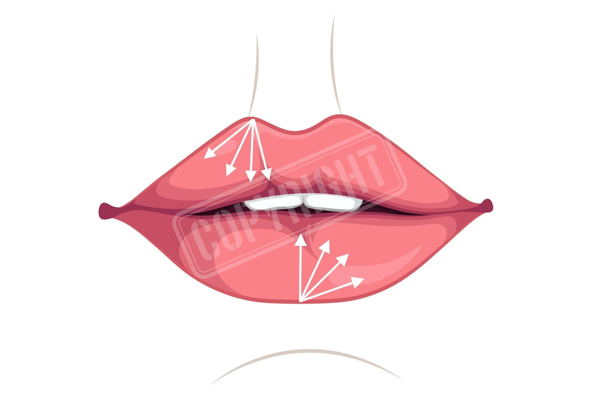 Fundamental Lip Filler Injection Techniques Bundle | Lip Anatomy ...