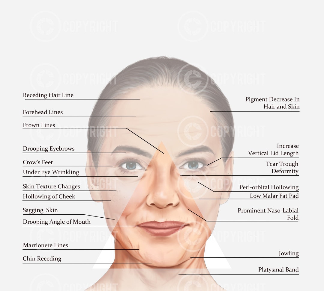 Bundle | Ageing of the Face and Neck | Botox & Filler Injector ...
