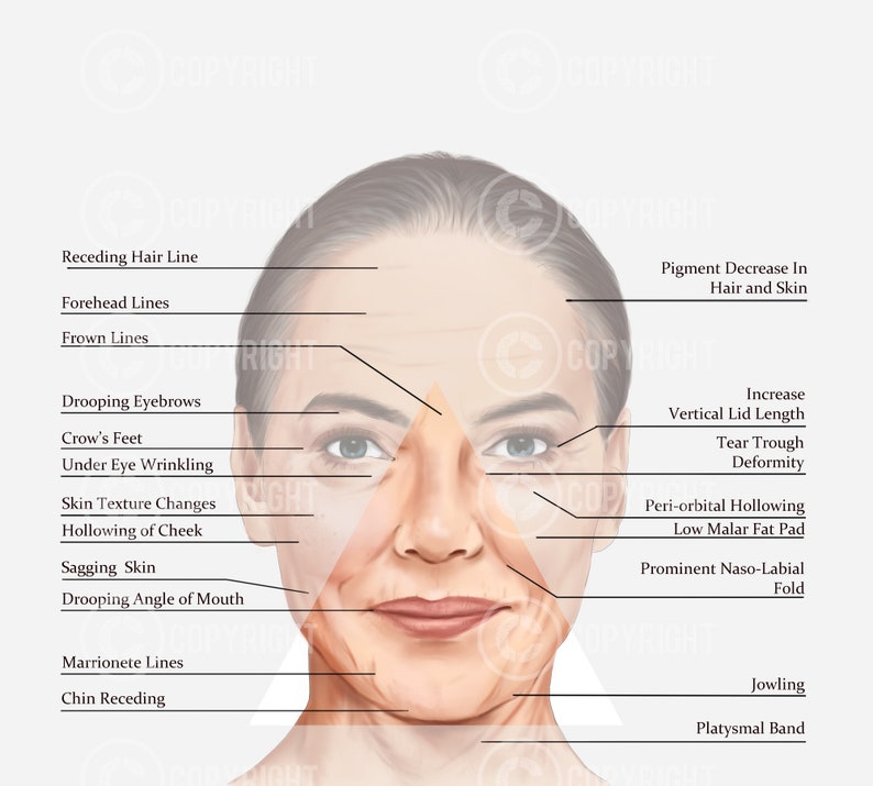 Bundle | Ageing of the Face and Neck | Botox & Filler Injector ...
