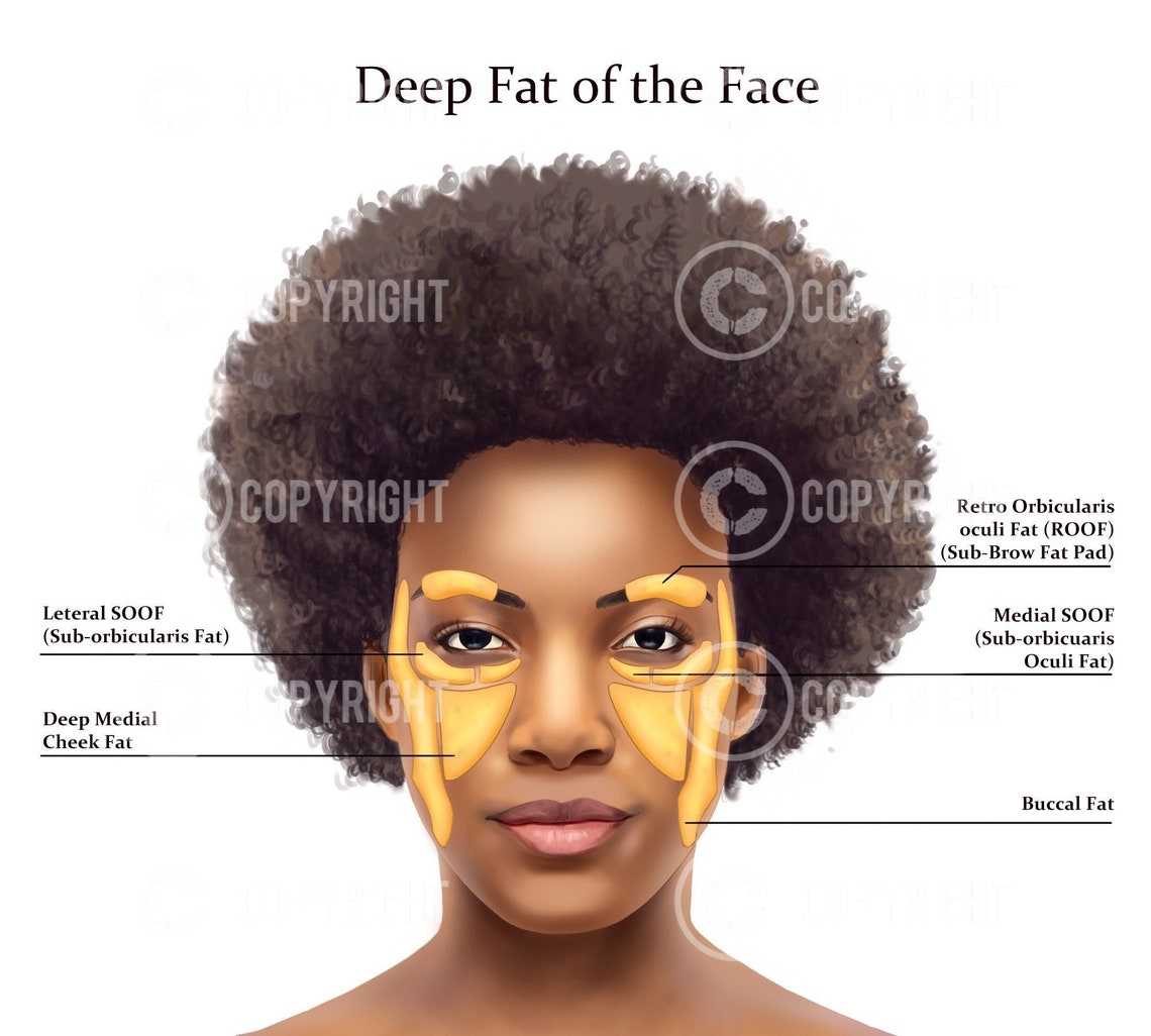 Deep Fat Pads the Face | Botox & Filler Injector | Anatomy | Art ...