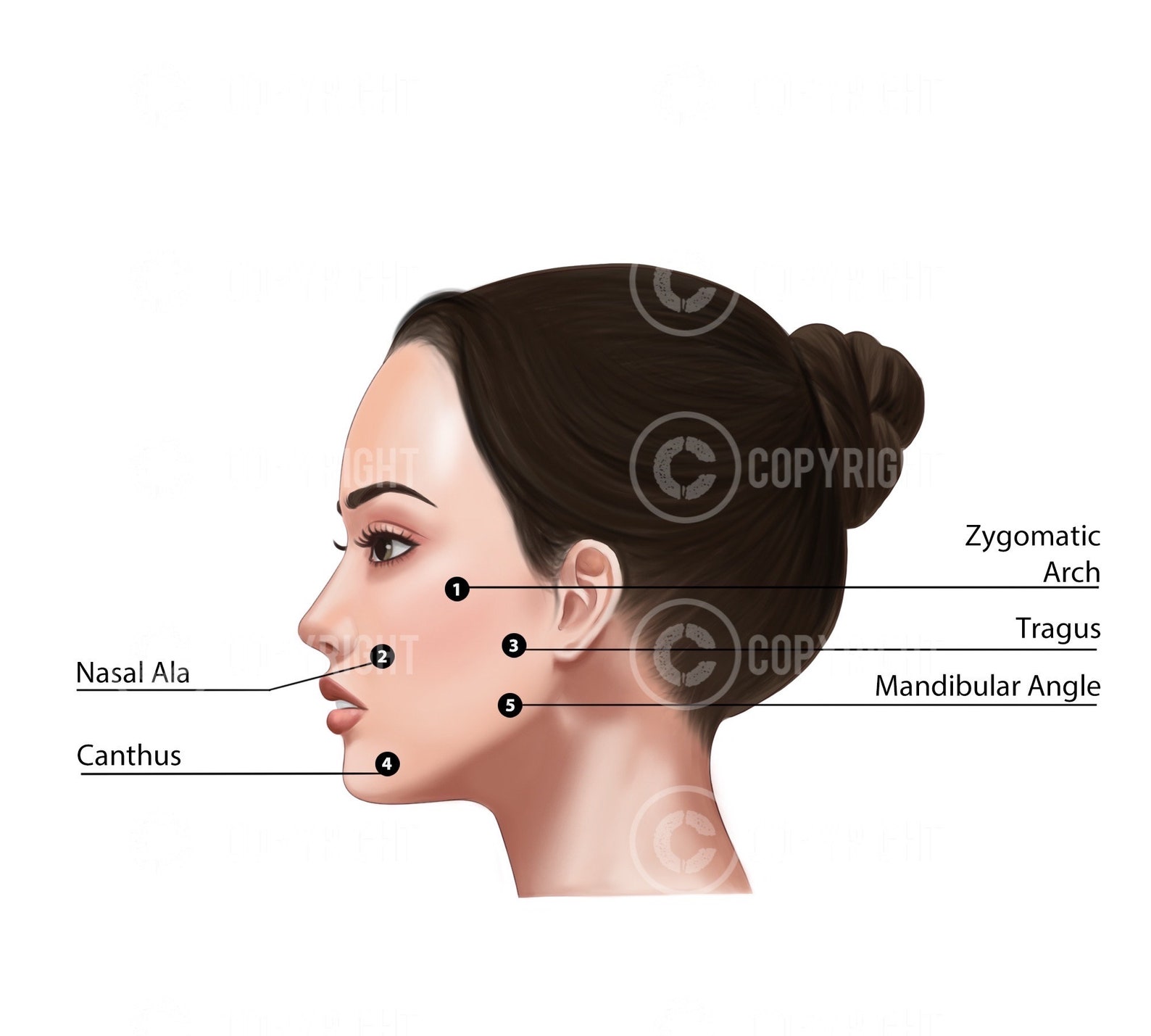 Profhilo 5 Point BAP Face Illustration Only| Skin Boosters | Injector ...