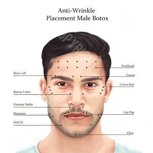 Male BOTOX Injection Points Bundle | Botox & Filler Injector | Anatomy ...