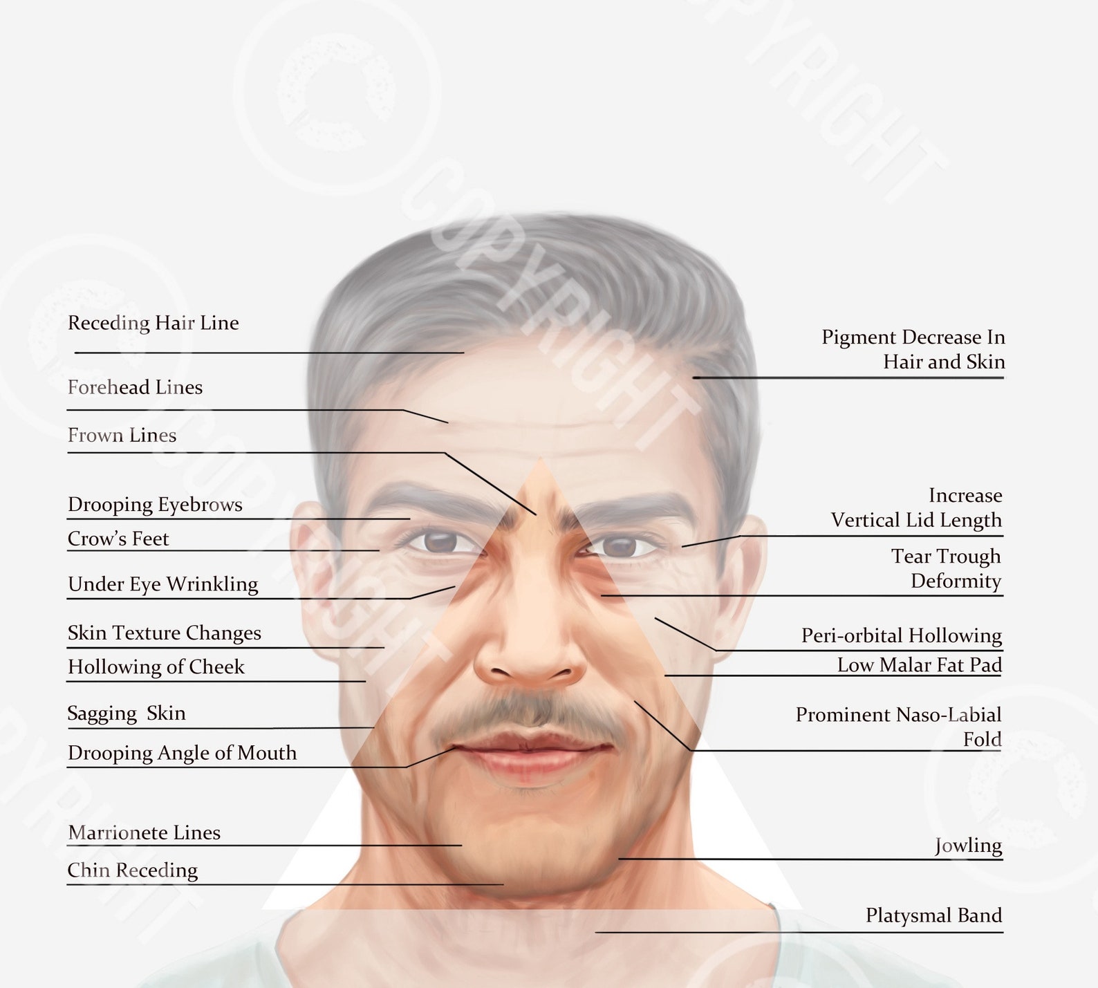 Male Aged Face and Neck | Botox & Filler Injector | Anatomy ...
