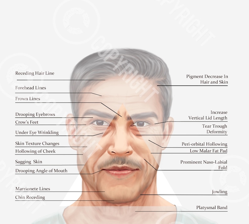 Male Aged Face and Neck | Botox & Filler Injector | Anatomy ...