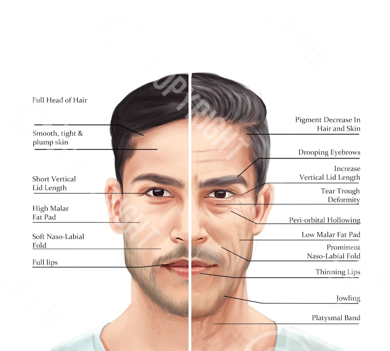 Male Ageing of the Face and Neck | Botox & Filler Injector | Anatomy ...