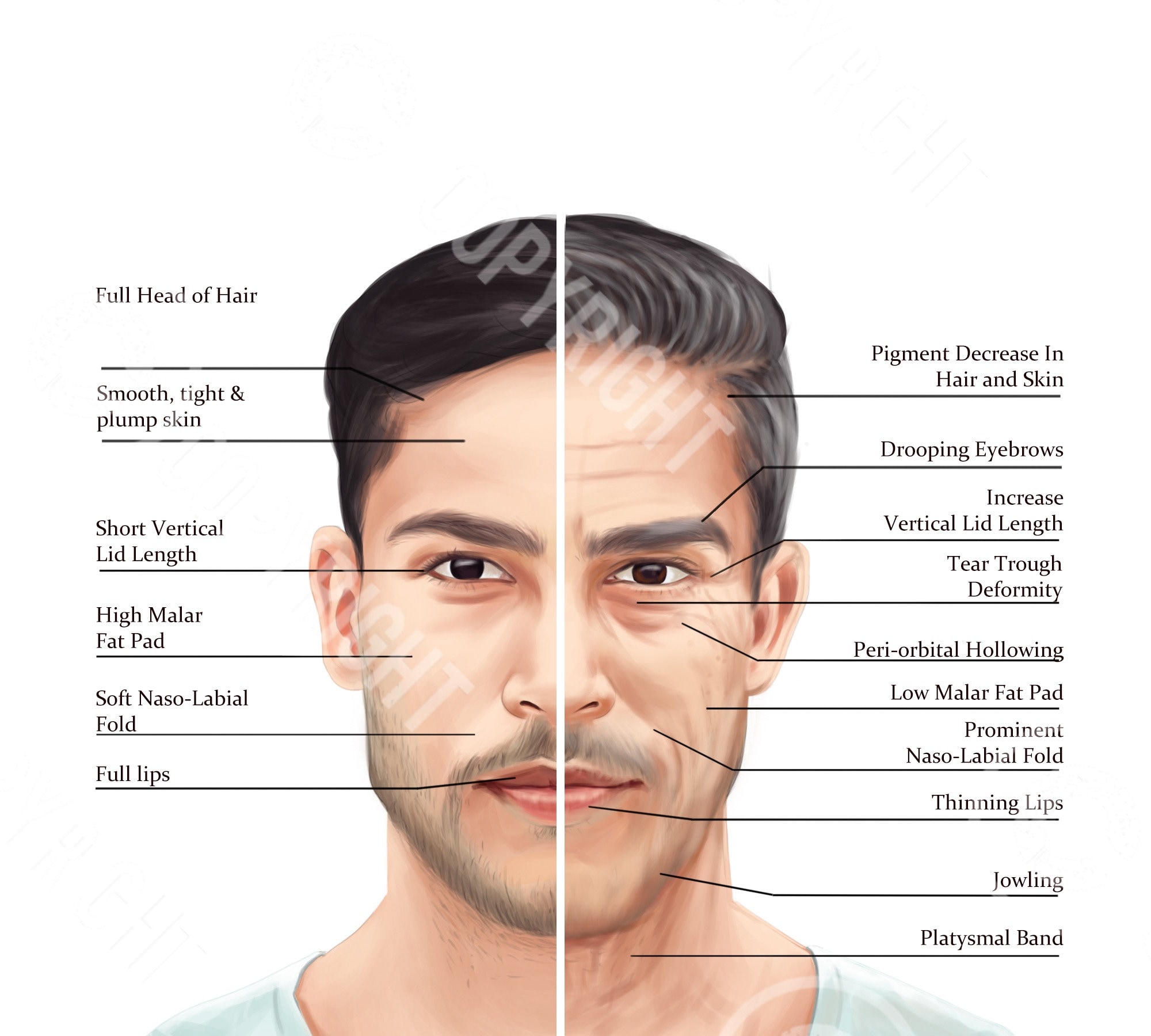 Male Ageing of the Face and Neck | Botox & Filler Injector | Anatomy ...