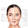 Blood Vessels the Face | Botox & Filler Injector | Facial Arteries ...