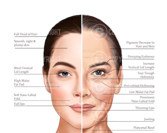 Muscles of the Face and Neck Botox & Filler Injector Anatomy ...