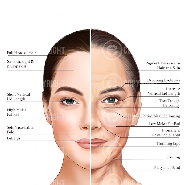 Male BOTOX Injection Points Bundle Botox & Filler Injector Anatomy ...