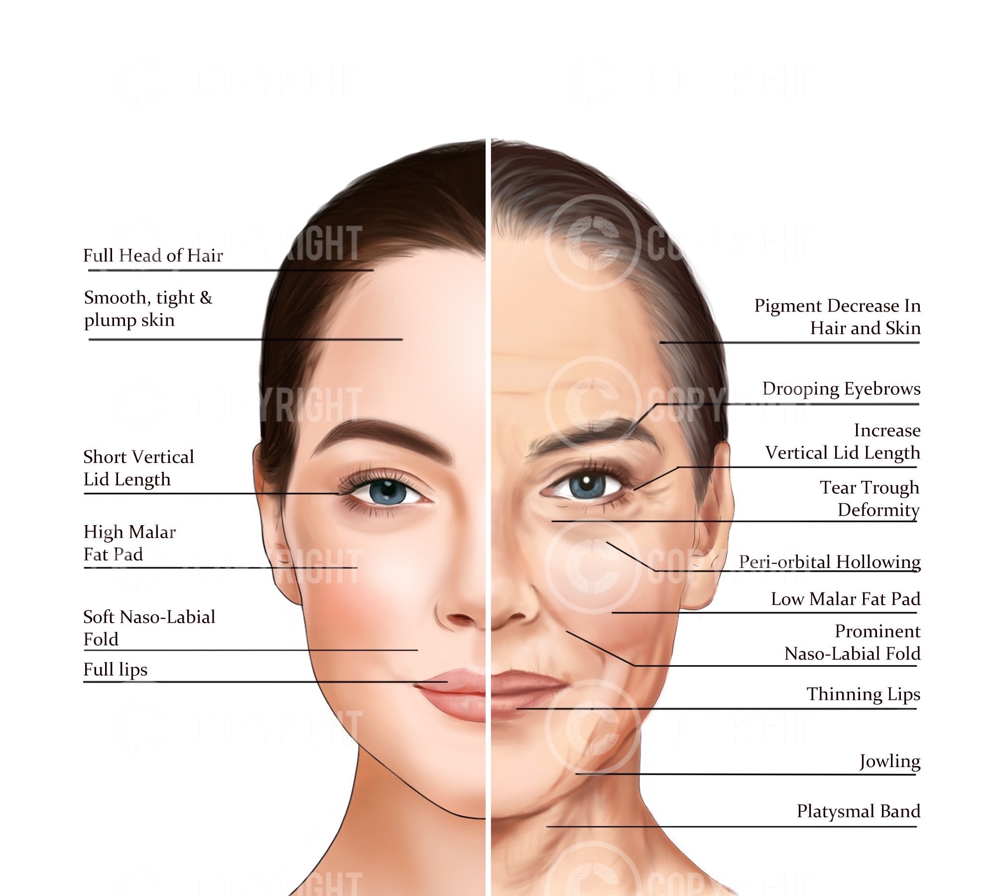 Ageing of the Face and Neck | Botox & Filler Injector | Anatomy ...