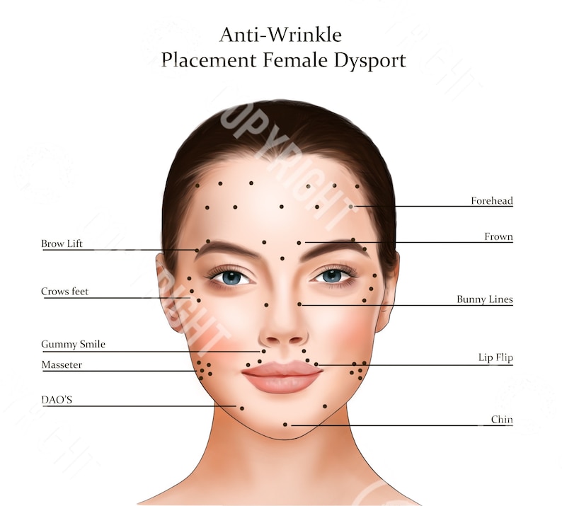Dysport Injection Points Bundle | Botox Filler Injector | Anatomy | Esthetician | Art ...