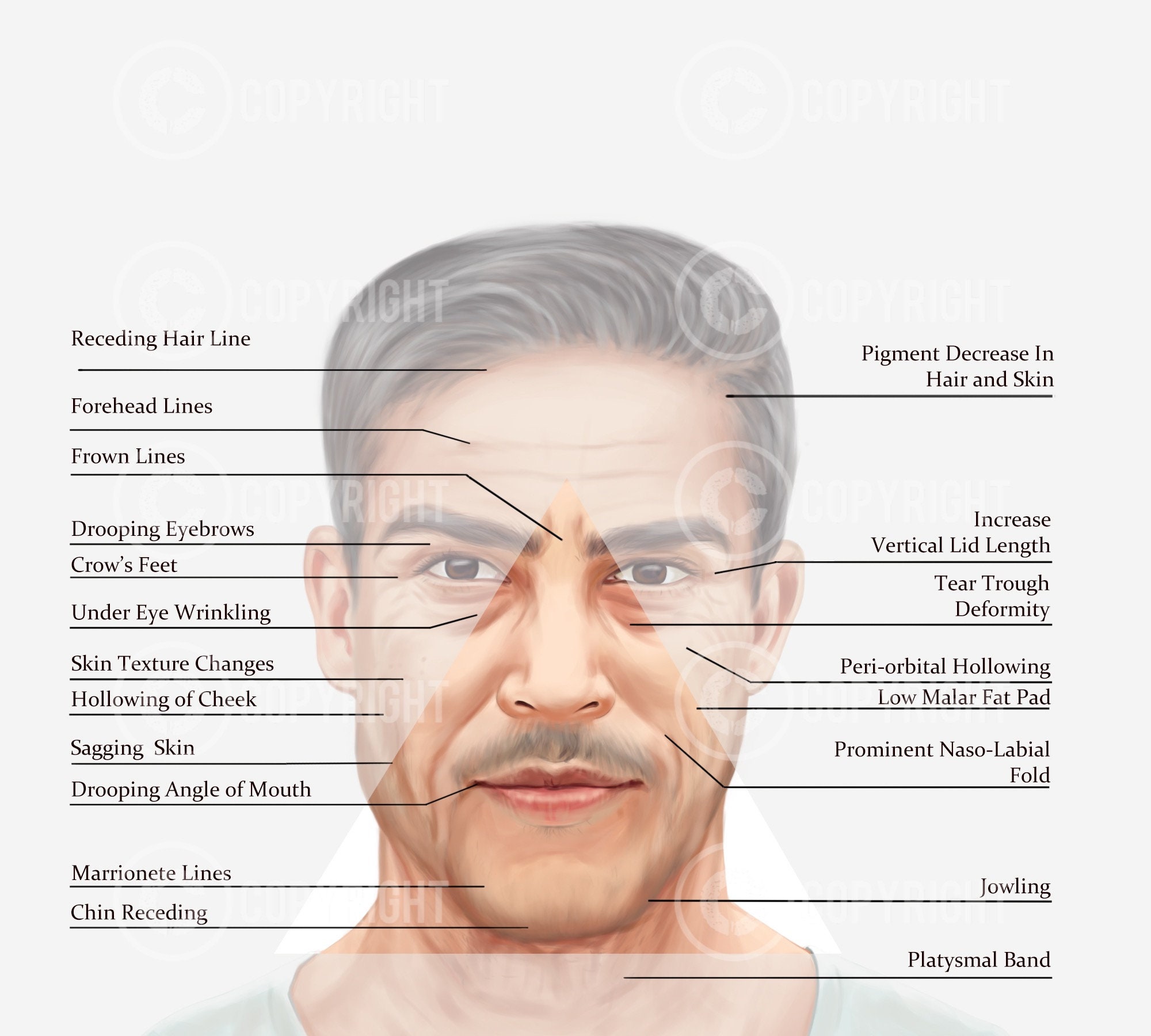 Bundle | Male Ageing of the Face and Neck | Botox & Filler Injector ...