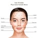 Botox Injection Points Bundle | Botox & Filler Injector | Anatomy | Art ...