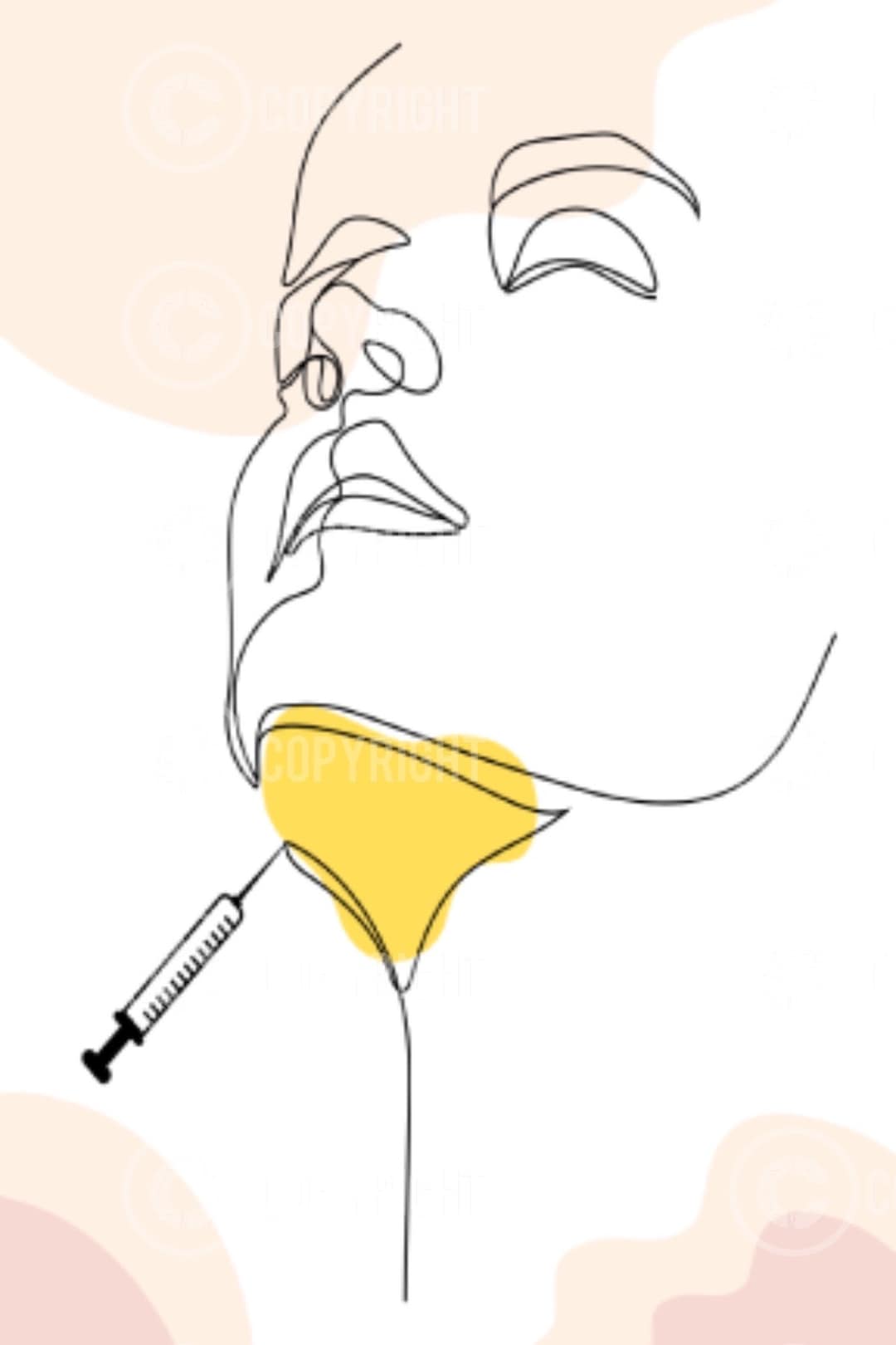 Line Art - Botox - Filler - Injector - Line Drawing Wall Decor - Fat ...