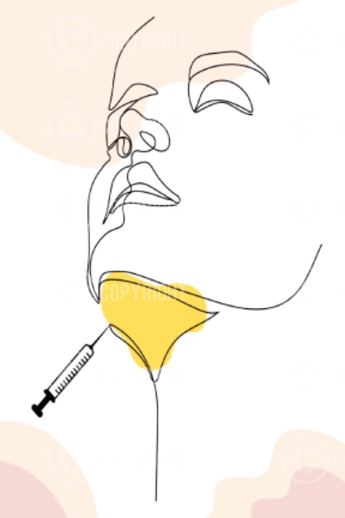 Line Art - Botox - Filler - Injector - Line Drawing Wall Decor - Fat ...