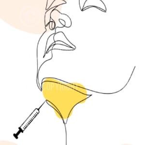Line Art - Botox - Filler - Injector - Line Drawing Wall Decor - Fat ...