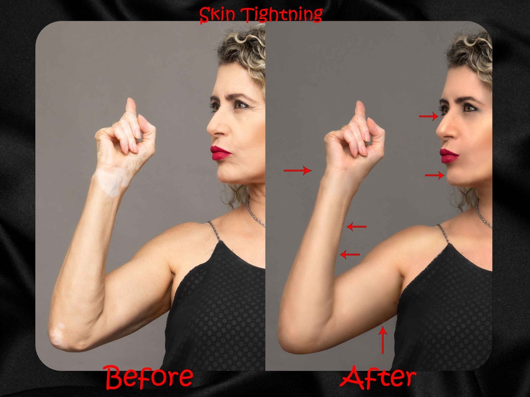 Body Uplift, Tightening Photo Editing, Professional Photo Retouching ...
