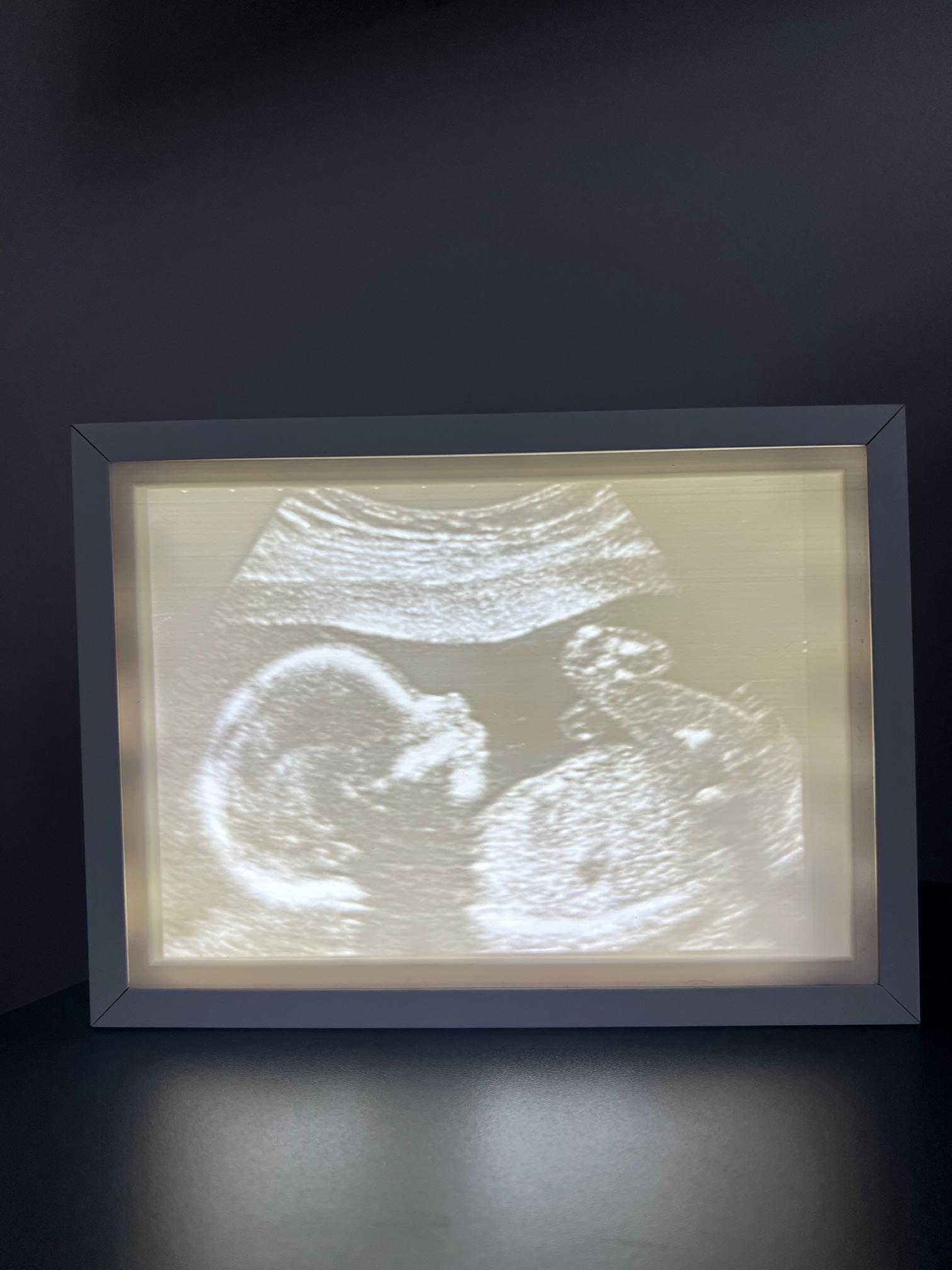 Customised Lithophane in Classic Frame, LED Backlight, USB Powered ...