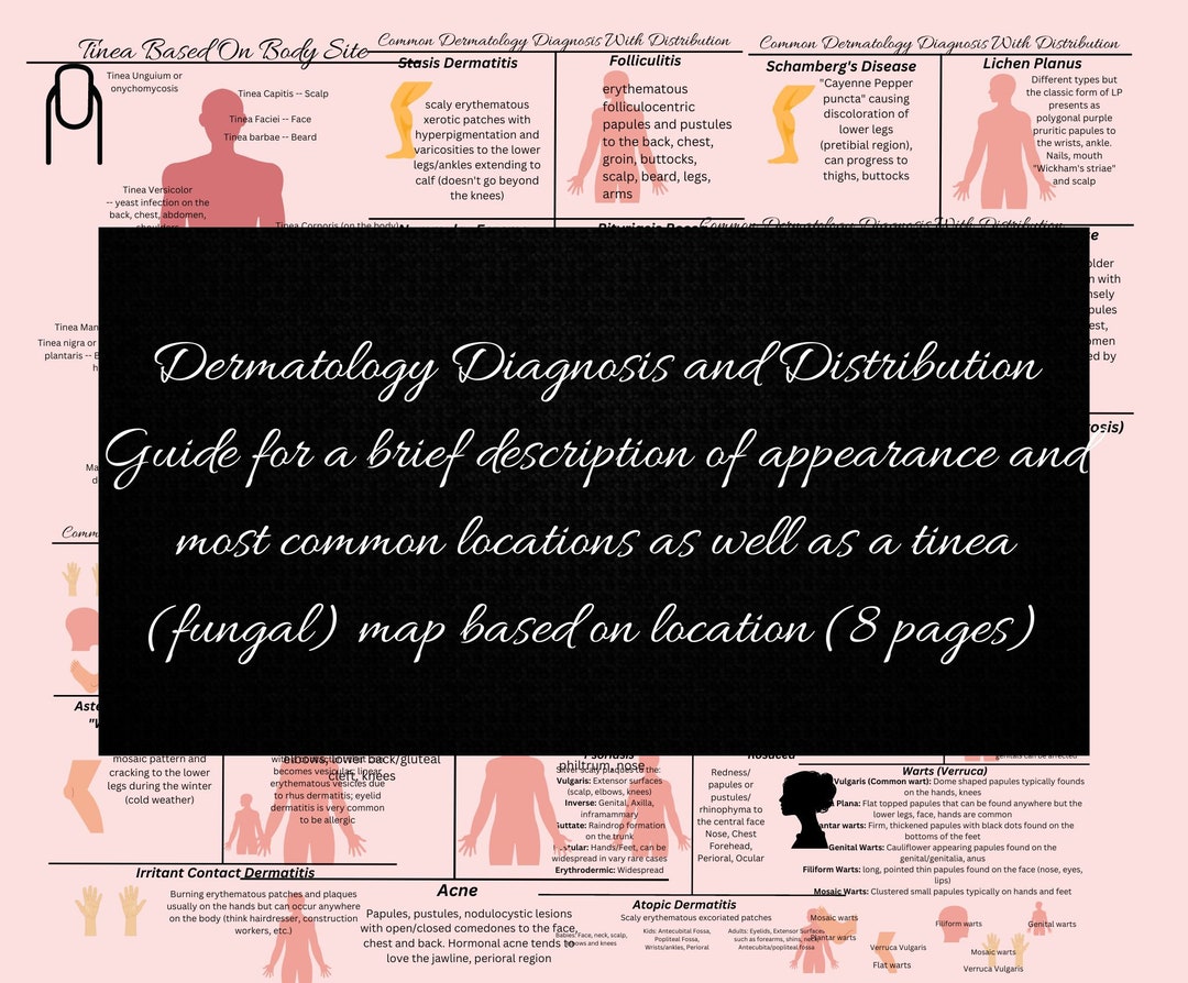 Dermatology Diagnosis Distribution Guide for Dermatologist, PA, NP ...