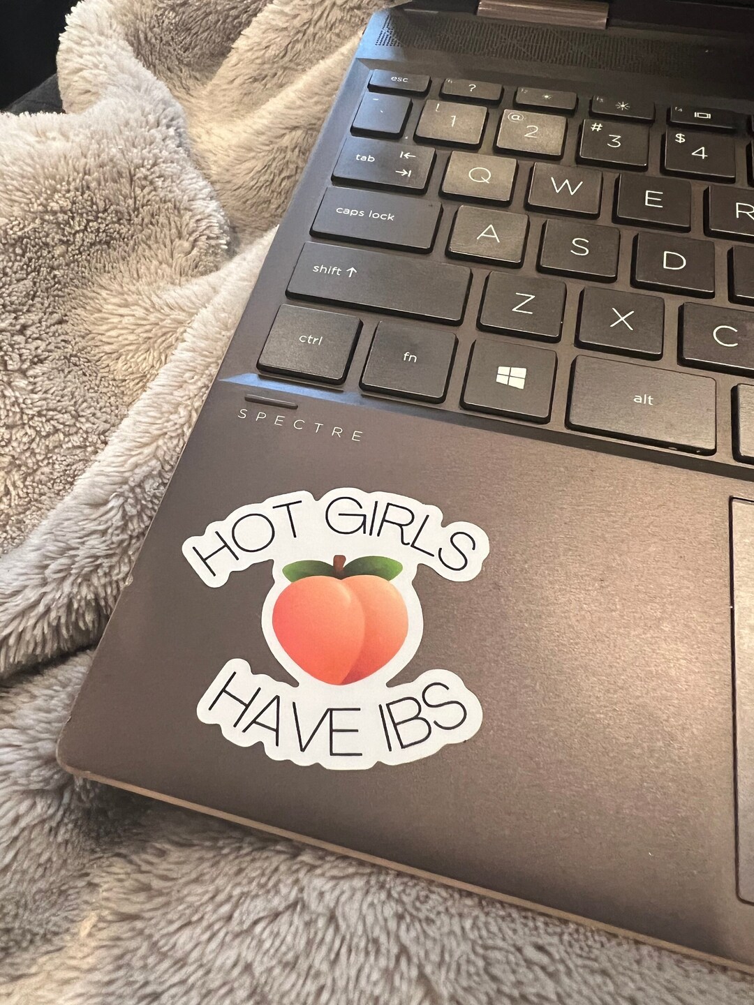 Hot Girls Have IBS Vinyl Sticker | IBS Humor | Gut Health Sticker ...