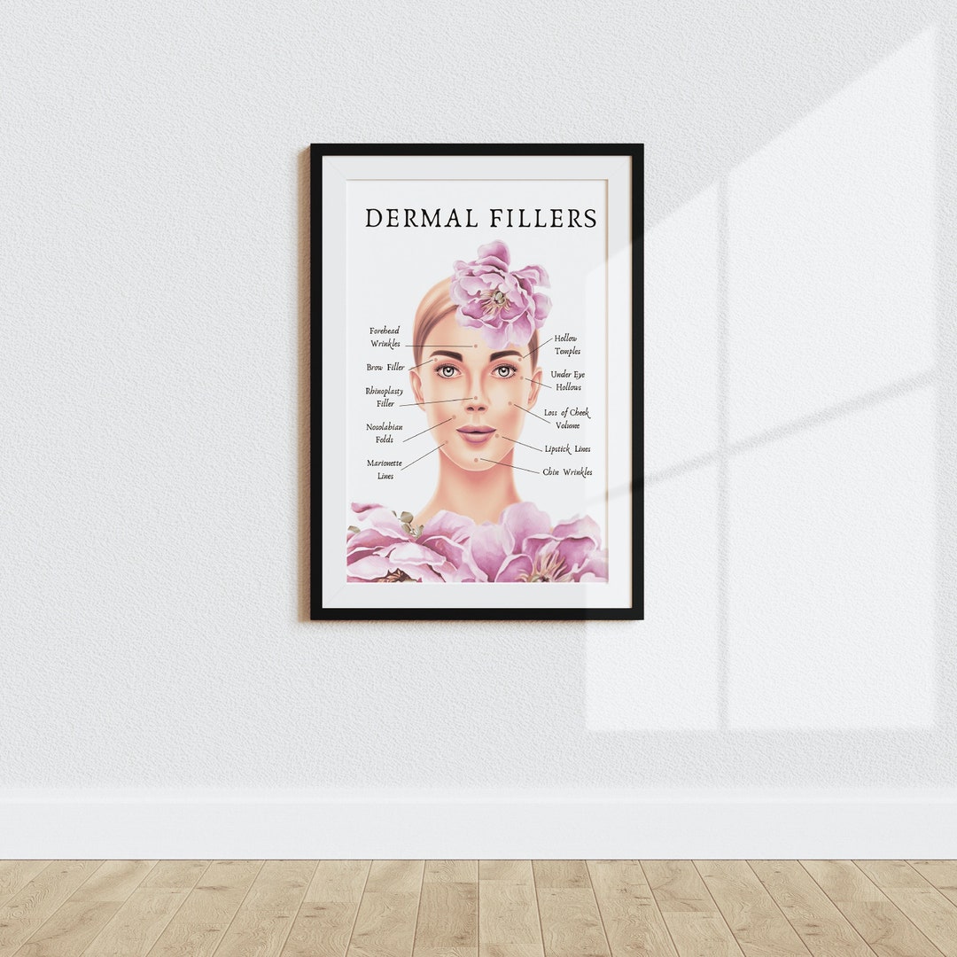 Dermal Fillers Face Map Poster for Beauty Salon and Medical Spa ...