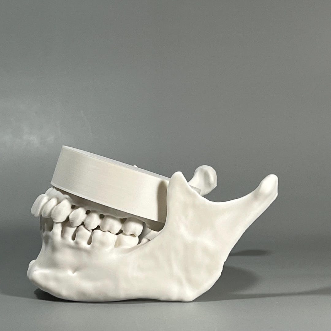 Human Maxilla and Mandible 3D Printed, Life Size Anatomical Model - Etsy