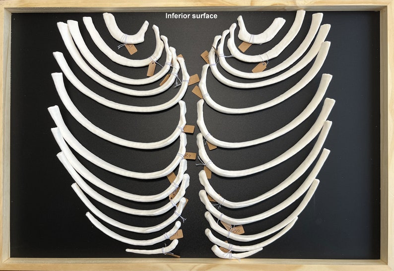 Human Ribs 3D Print, 18yo Male - Etsy