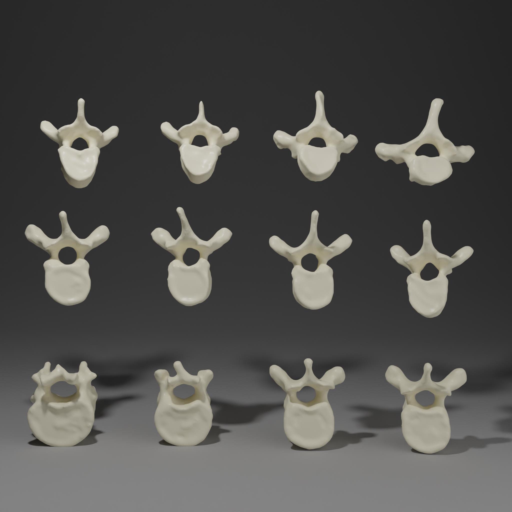 3D Printable Thoracic Vertebrae, Life Size - Etsy