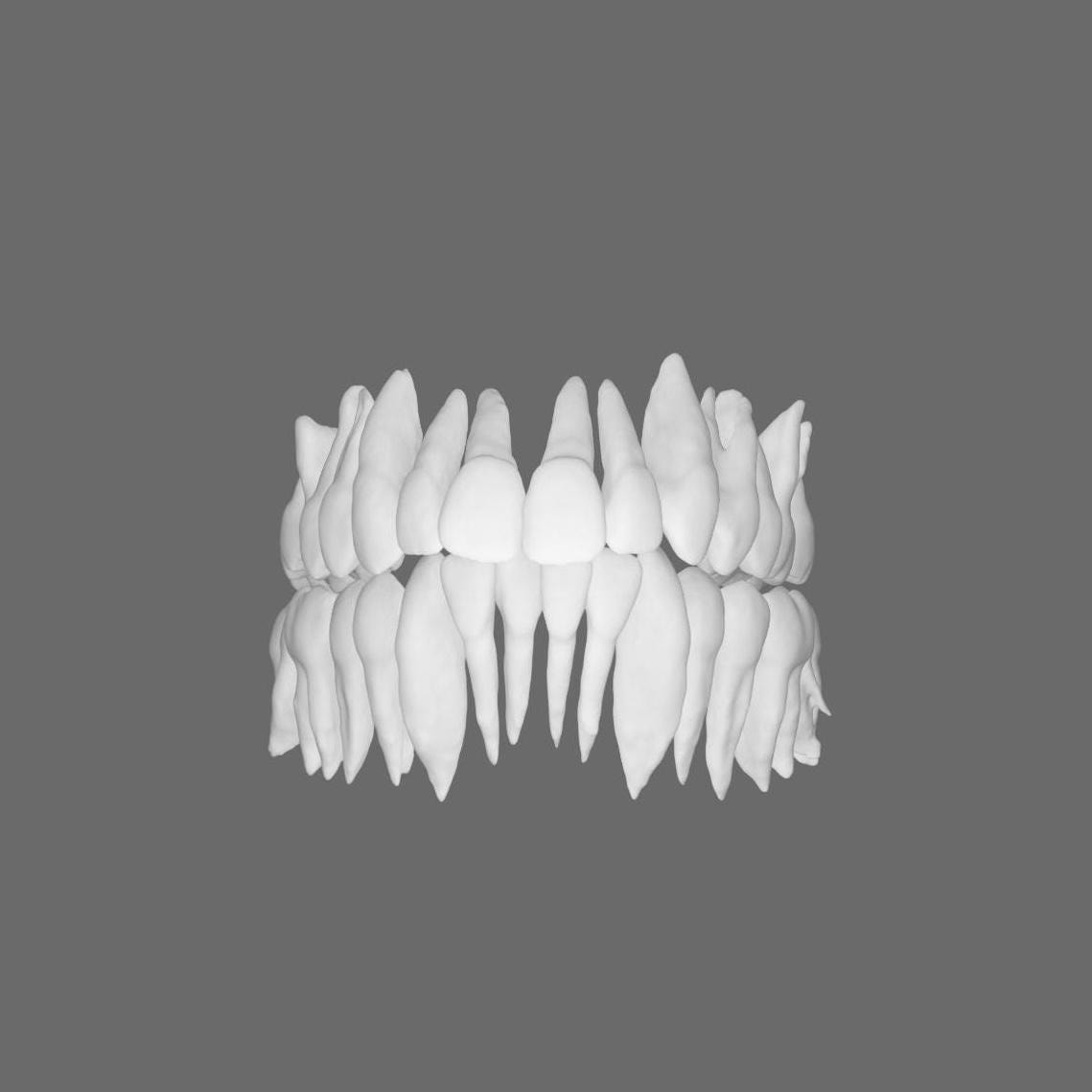3D Printable Human Teeth Stls From CT Scan - Etsy