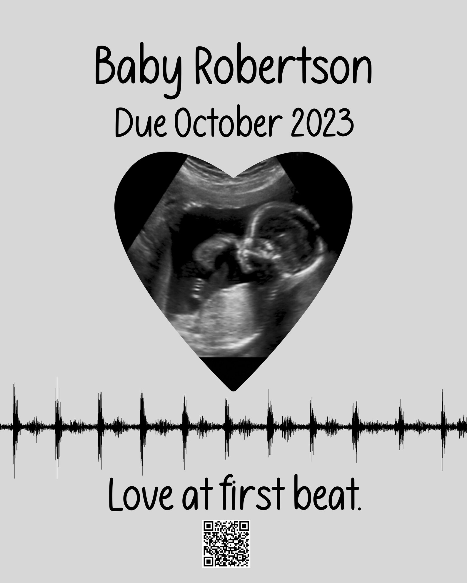 Ultrasound Soundwave QR Code Art | Sonogram Art | Sonogram Wall Decor ...