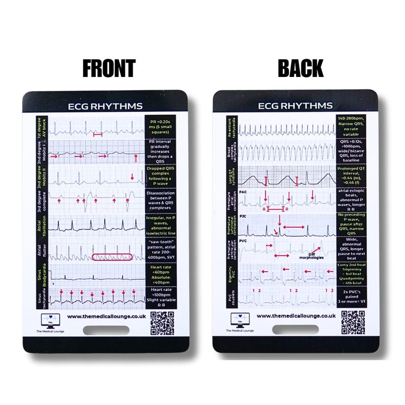ECG Rhythm Reference Card | 15 Abnormal ECG Strips With Visual Guide ...