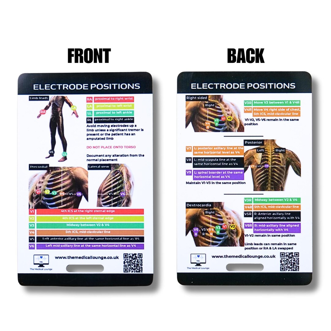 ECG Electrode Placement Card | Limb, Chest, Right-sided and Posterior ...