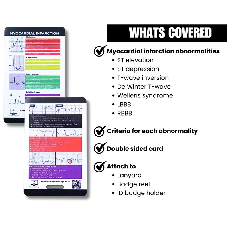 Myocardial Infarction ECG Reference Card: Nurse/paramedic Lanyard Guide ...