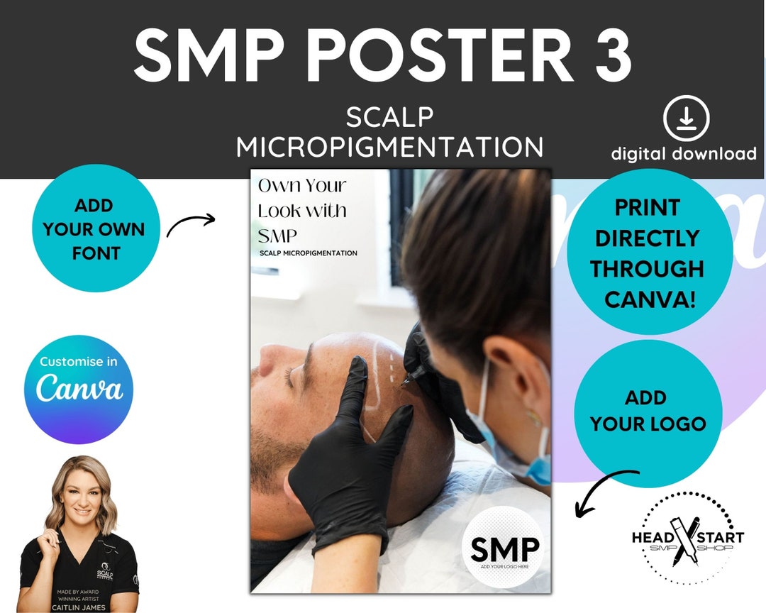Scalp Micropigmentation (SMP) Poster: Professional Hair Restoration ...