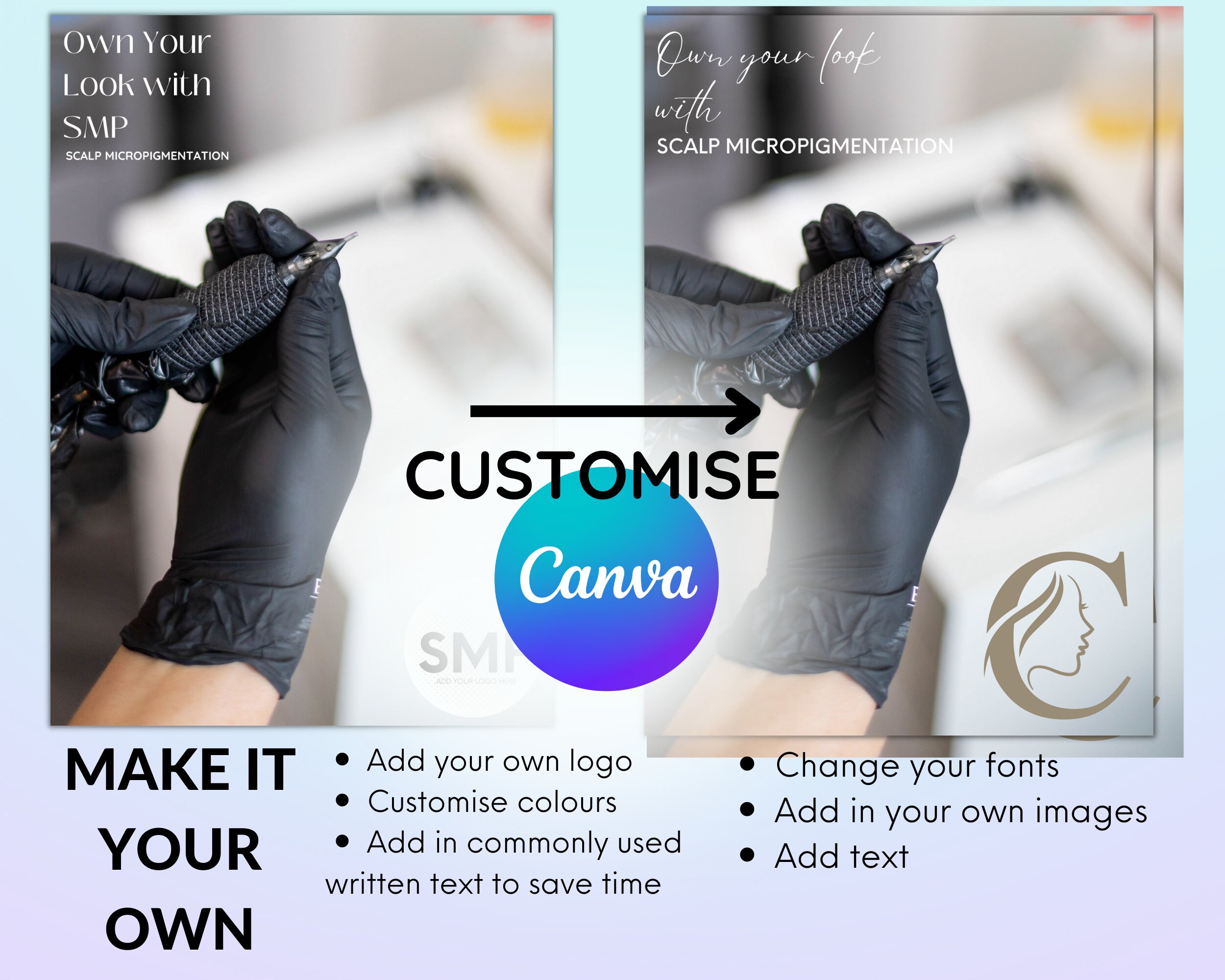 Scalp Micropigmentation SMP Poster Actual Scalp Micropigmentation ...