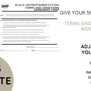 Scalp Micropigmentation (SMP) Treatment Agreement Form Including ...