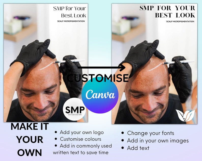Scalp Micropigmentation (SMP) Poster, Advertising, Instant Download in ...