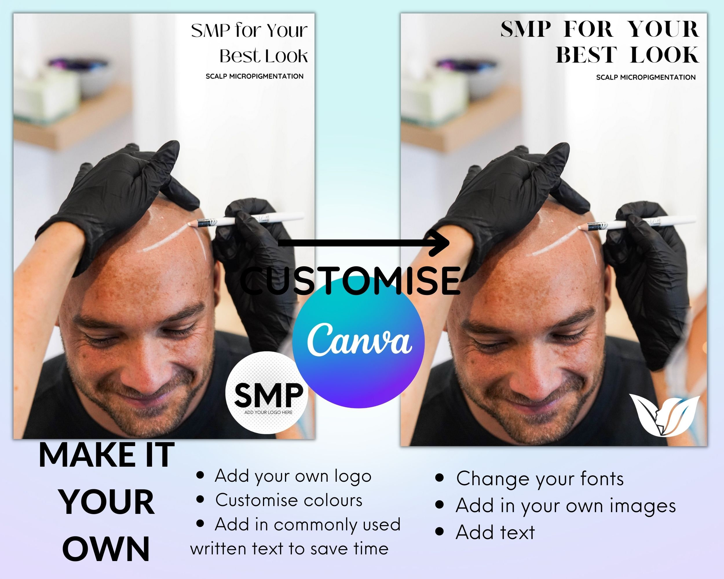 Scalp Micropigmentation (SMP) Poster: Advertising Template (digital ...